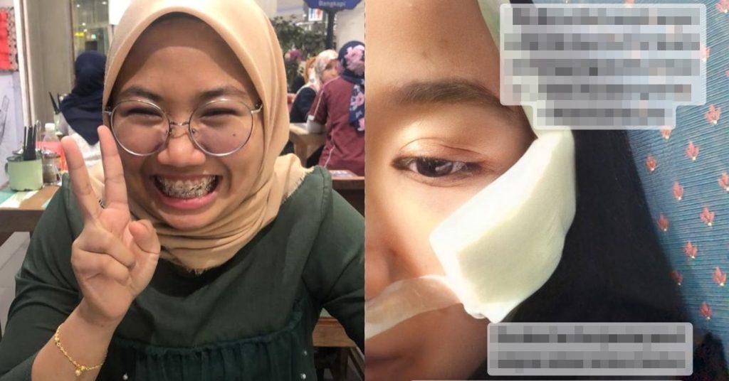 Tumbuk Muka Isteri Berkali-Kali, Pelakon Lelaki Popular Kini Jadi Buruan