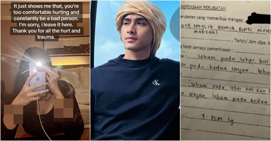 aniq suhair | Beautifulnara -Terkini dan Sensasi