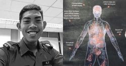 “Peluang Untuk Hidup Mungkin Lebih Tinggi” – Dr Samhan Jelaskan ...