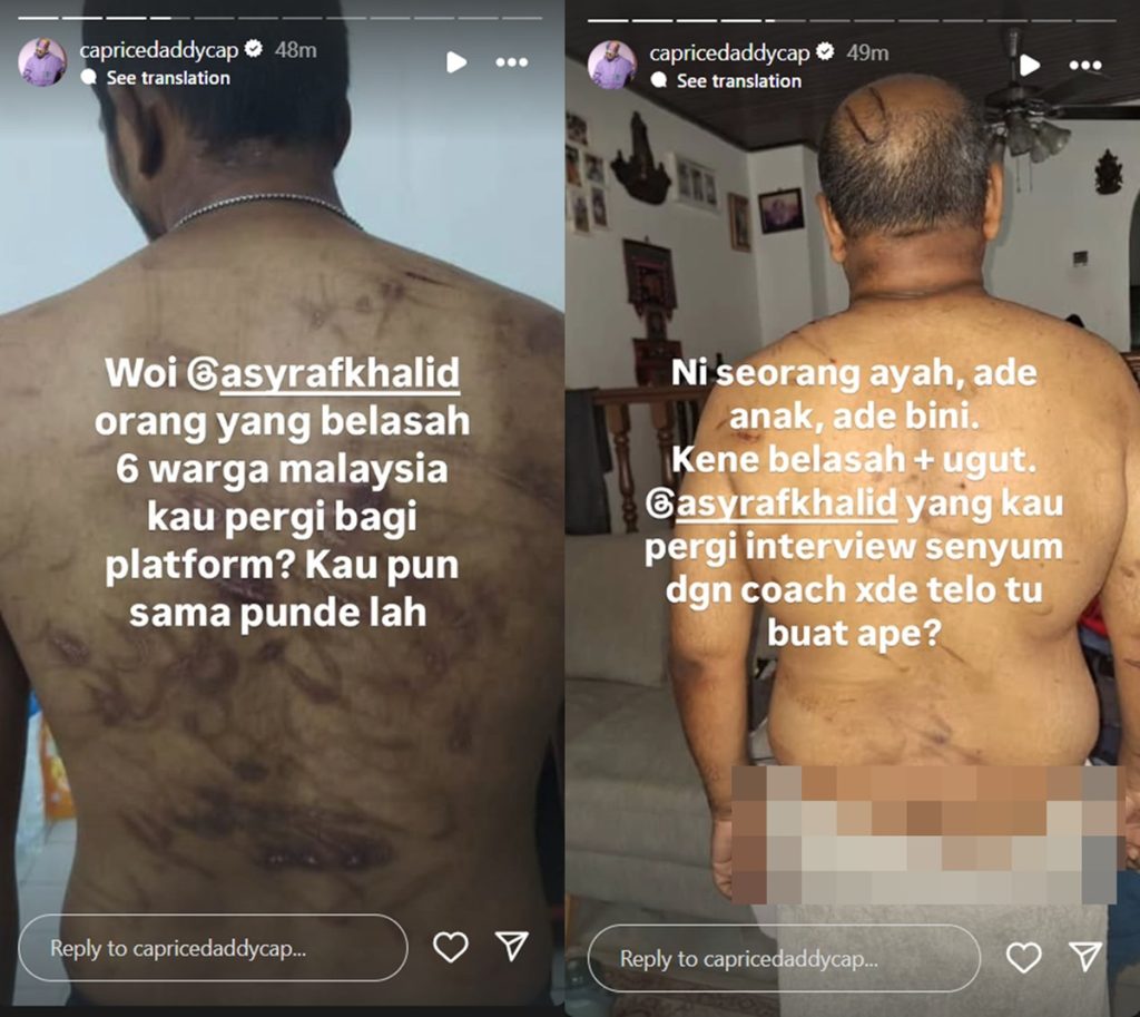 “Hey Bod*h, Kau Pun Sama Punde Lah” – Pernah Dapat Ugutan ‘Bun*h’, Caprice Selar Asyraf Khalid ...