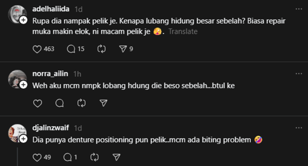 Video ‘Before & After’ Tular, Perubahan Wajah Kim Seri Jadi Bualan Ramai – “Biasa Repair Muka ...